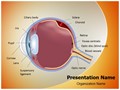 Professional Retinal detachment Editable PowerPoint Template